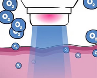 SECRETREZA™ RF Wand